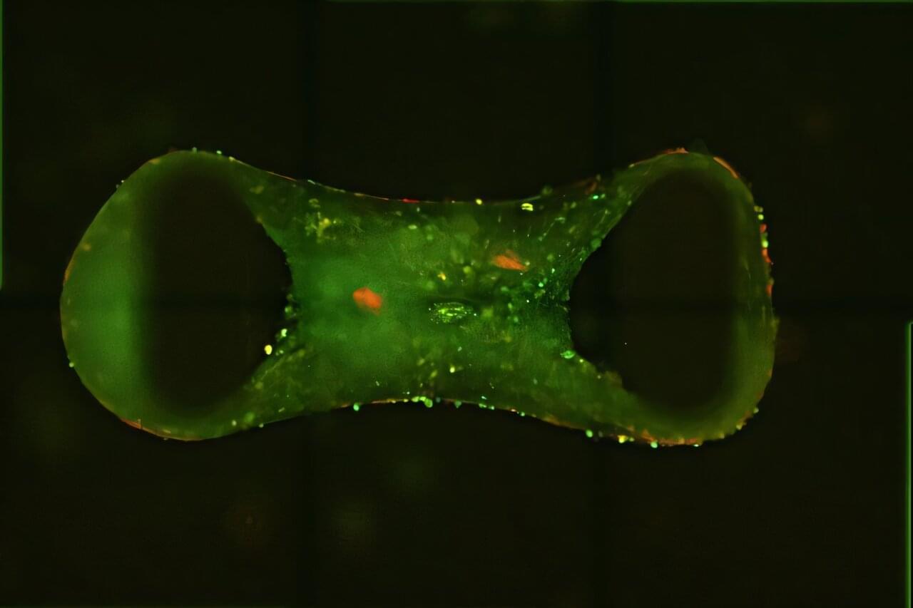 Lab-grown ‘tiny hearts’ bring hope for children and adults with genetic ...