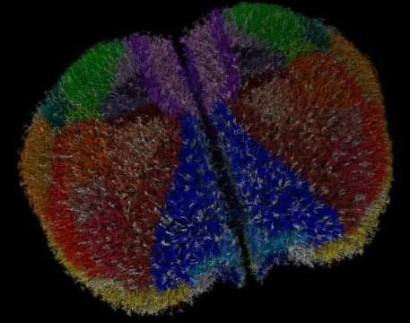 One of world’s most detailed virtual brain simulations is changing how ...